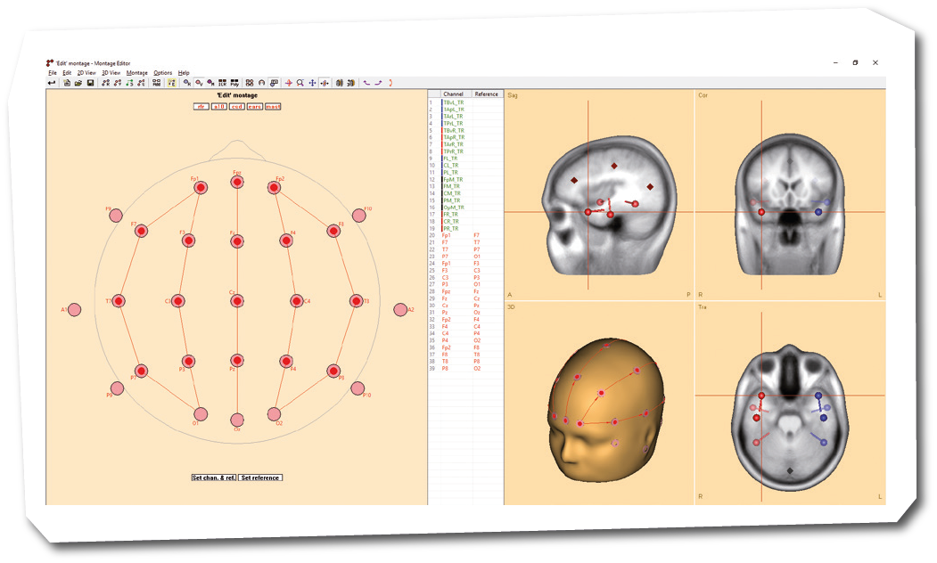 BESA Research Software | Brainbox